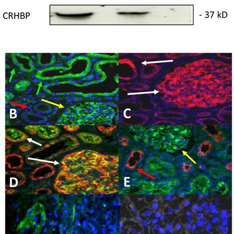 Schematic Representation Of Crf Crfr1 And Crfr2 Expression In The