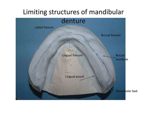 Anatomy For Complete Denture Pdf