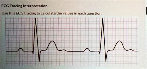 Solved Calculate Hr Heart Rate Using Two Different Methods Ecg Tracing Interpretation Use