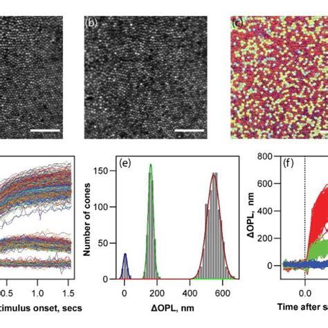 Representative Example For Cone Classification For Subject S4