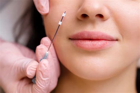 Thread Lift Vs Facelift Which Is Right For You