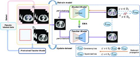 Illustration Of Our Proposed Essegild Framework For Segmentation Of Ild