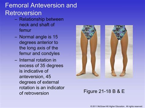 Ppt Chapter 21 The Thigh Hip Groin And Pelvis Powerpoint