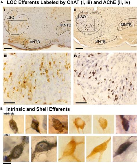 Labeled Cholinergic Loc Efferent Neurons Loc Neurons Were Labeled