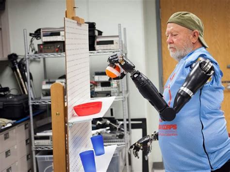 Watch The First Man On Earth To Control Two Artificial Arms With His Mind
