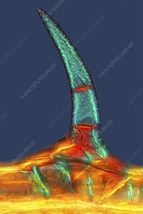 Aniseed Trichome Light Micrograph Stock Image C026 2555 Science Photo Library