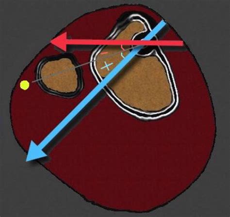 Schematic Drawing Demonstrating The Trajectory Lines Of Drilling In Download Scientific Diagram