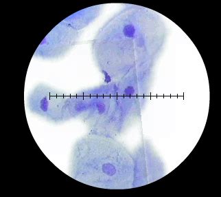 Cheek Cells Under Microscope 400x