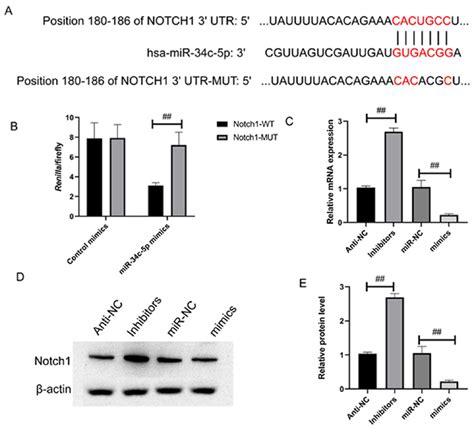 notch1 is a target of mir 34c 5p a the 3 utr of notch1 mrna