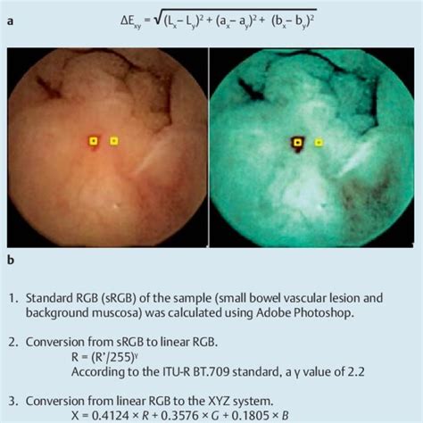 Pdf Clinical Utility Of Capsule Endoscopy With Flexible Spectral Imaging Color Enhancement For