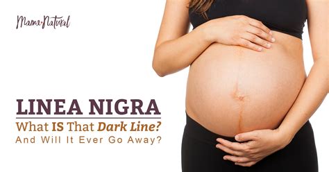 Linea Nigra What Is That Dark Line And Will It Ever Go Away
