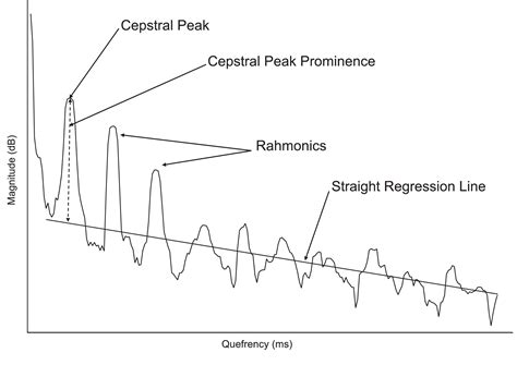 Cpps And Voice Source Parameters Objective Analysis Of The Singing