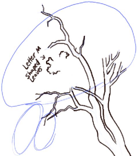 Tree Drawing Simple Art Drawings Simple Drawing Trees Basic Drawing How To Draw Steps Learn