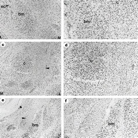 Photomicrographs Of Sections From Three Representative Brains Showing Download Scientific