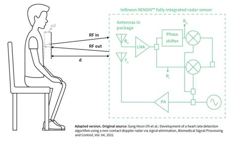 Contactless Measurement Of Vital Signs With Radar Sensors