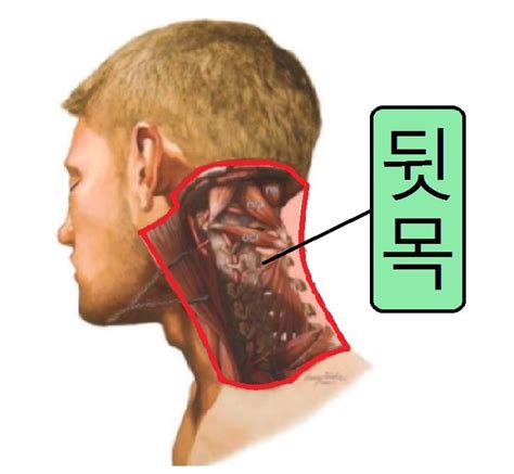 뒷목 결림 근육 구체적 설명 네이버 블로그