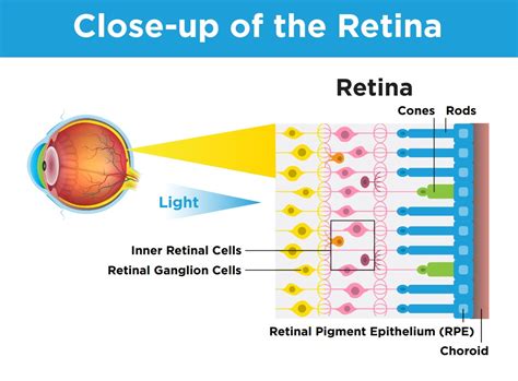 Age Related Macular Degeneration Fighting Blindness Canada Fbc