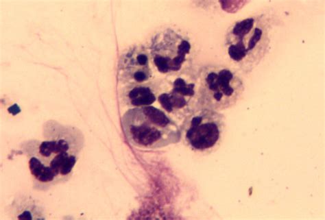 Laboratory Flashcards Quizlet