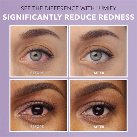Buy Lumify® Redness Reliever Eye Drops 75ml