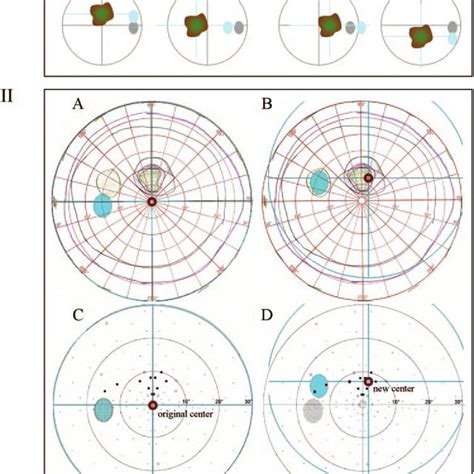 Distribution Of Scotoma Type And Fixation Behavior At Baseline In