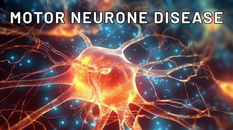 The Silent Battle Of Motor Neurone Disease Reddy Care Physical