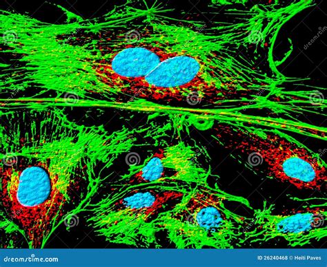 The Pulmonary Artery And Aorta Vintage Engraving Stock Illustration