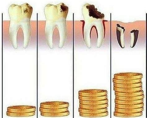 Шүд арчилгаа зөвөлгөө