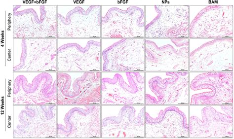 Hande Staining Of The Periphery And Centre Of The Regenerated Bladder