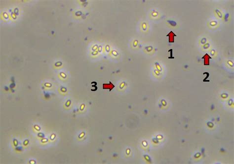 Phase Contrast Microscopy 100x Of Terribacillus Sp Aidingensis