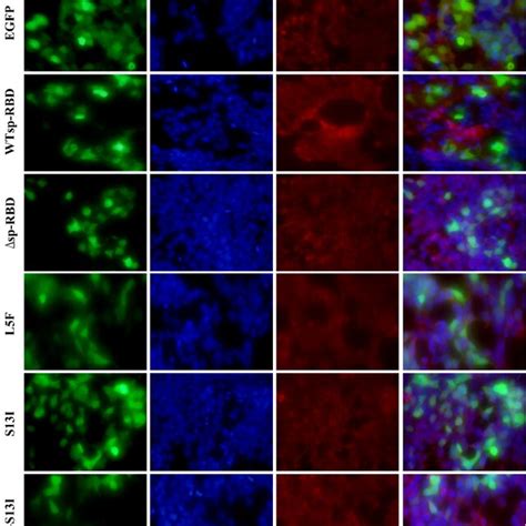 Signal Peptide Comparison Of Sars Cov 2 Spike Protein A Signal Download Scientific Diagram