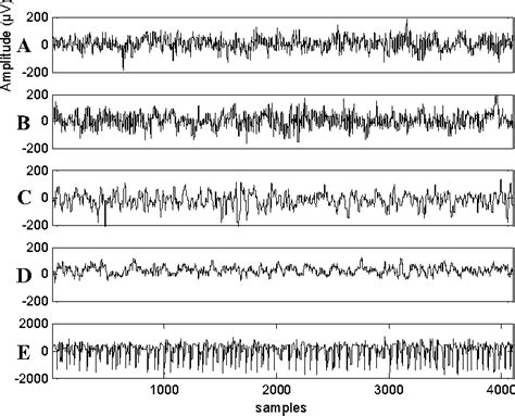 figure 1 from classifying discrete interval densities of eeg signals by