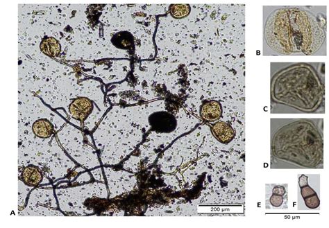 А Glomus Spores And S B Pinaceae Pollen C D Bryophyta Spores
