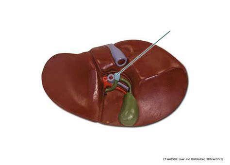 Solved Lt W425ng Liver And Callbladder 3esciensficowhich