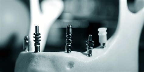 Titanium Grade 2 Composition Properties And Processing Challenges