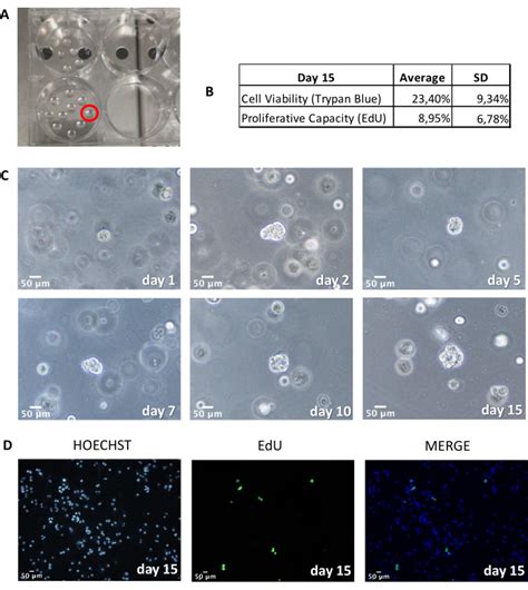 Rat Liver Perfusion And Primary Hepatocytes Isolation An Old Procedure Crucial For Cutting Edge