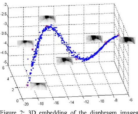 Figure 2 From Tumor Targeting For Lung Cancer Radiotherapy Using Machine Learning Techniques