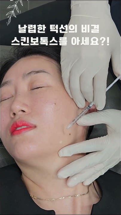 턱라인 스킨보톡스 맞고 날렵한 턱선으로 다시 태어나기😉 Shorts Youtube