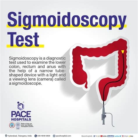 Sigmoidoscopy Procedure