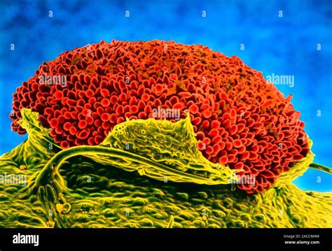 Rust Fungus Coloured Scanning Electron Micrograph SEM Of The Fungus Uromyces Fabae Which