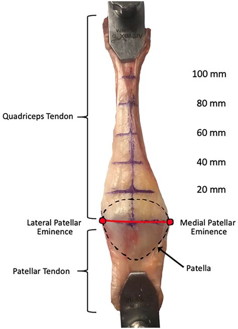 Quadriceps Tendon Anatomy