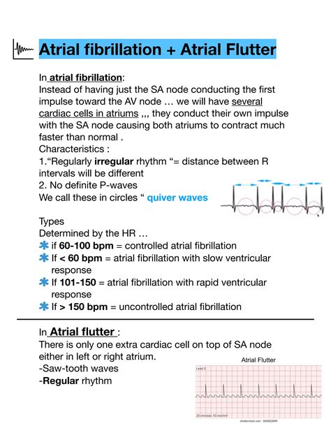 Ecg Interpret Notes Pdf