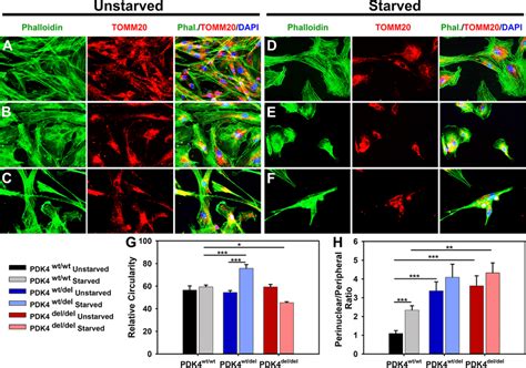 Dp Fibroblast Cellular Morphology And Mitochondrial Localization Ac