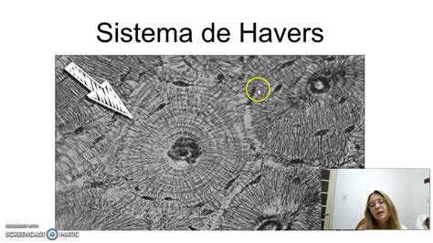 Sistema De Havers Histología Youtube
