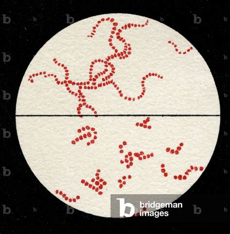 Image Of Colony Of Streptococcus Pyogenes 1906 Litho By German School 20th Century