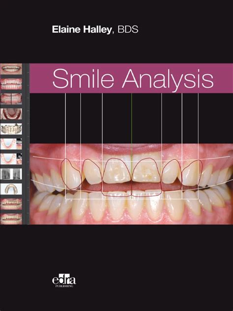 Smile Analysis Pdf Pdf Dentistry Physical Attractiveness