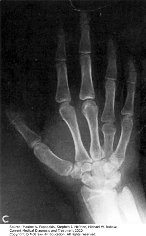 Cmdt Media Library Accessmedicine Mcgraw Hill Medical