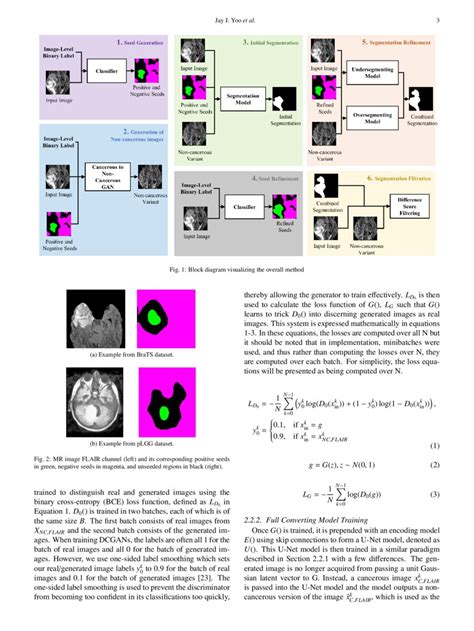 A Novel Gan Based Paradigm For Weakly Supervised Brain Tumor