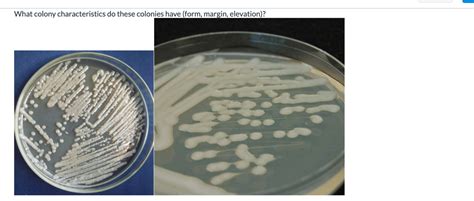 Answered What Colony Characteristics Do These Bartleby