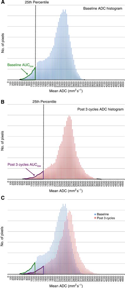 Adc Histogram Analysis Derivation Of Auclow Pre And Post Treatment Download Scientific