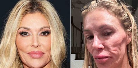 Brandi Glanville in yüzü eriyor Karadenizgazete com tr